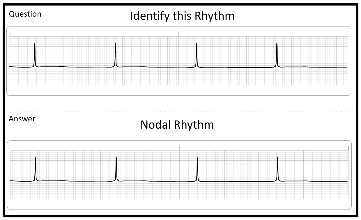 Rhythm Review Flashcards | Prepare ACLS/BLS exam | ACLS Certification ...