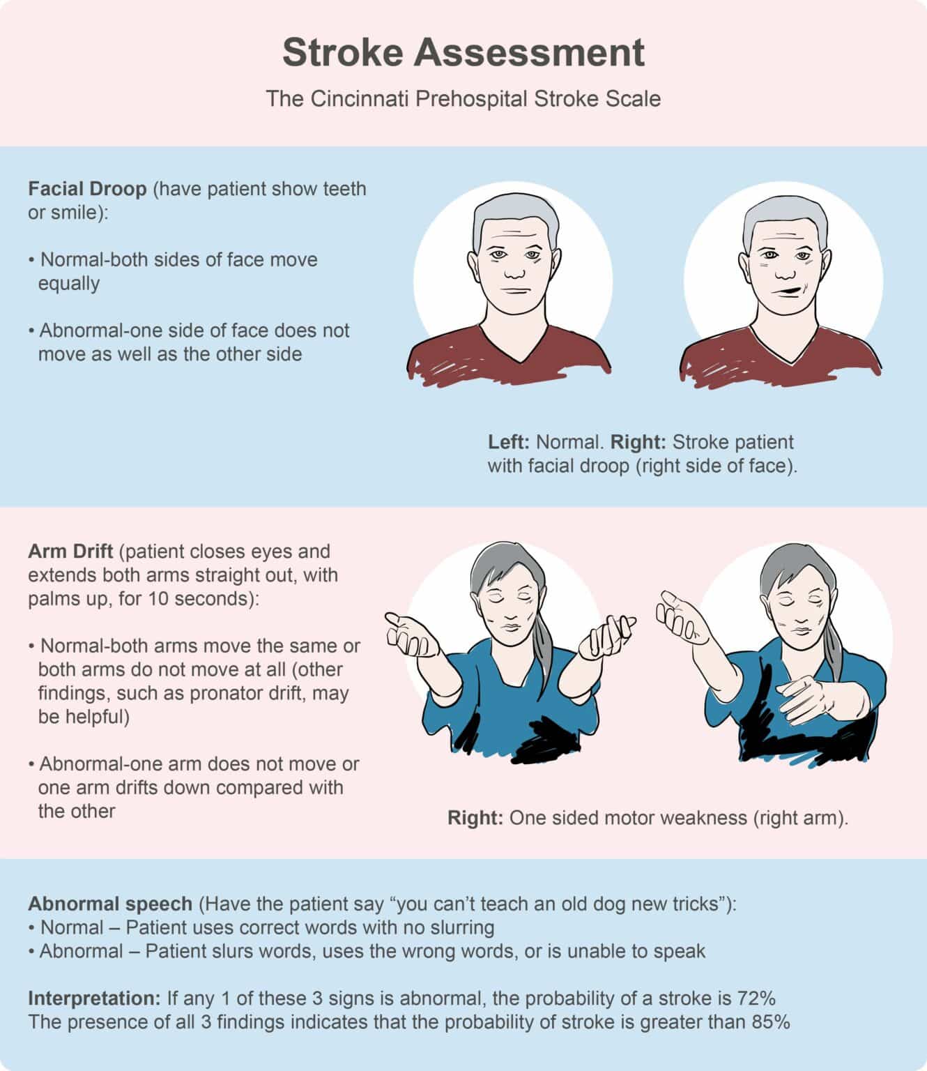 Topic - ACLS Case: Acute Stroke | ACLS Course | ACLS Certification ...