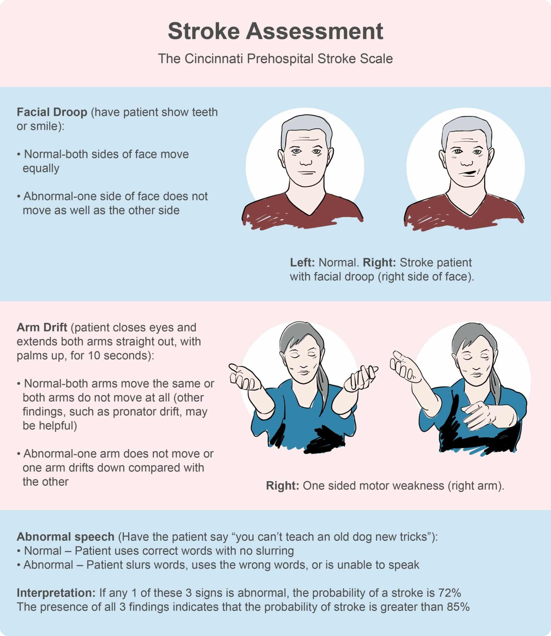 Topic - ACLS Case: Acute Stroke | ACLS Course | ACLS Certification ...