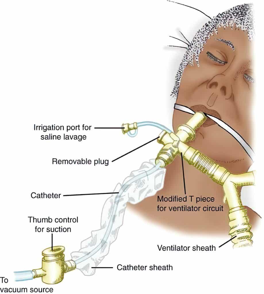 Topic - Adjuncts for Airway Control and Ventilation | ACLS Course ...