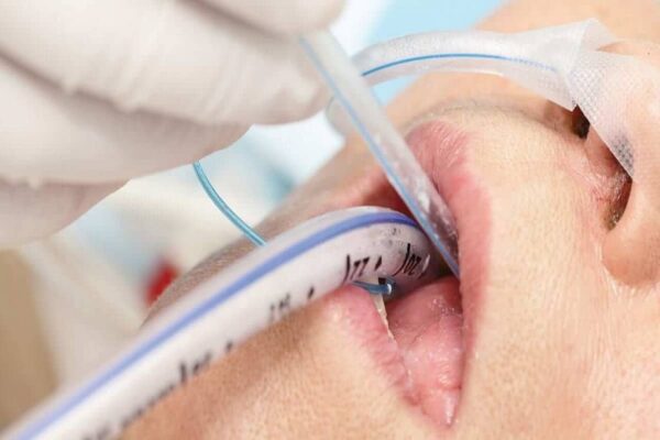 Topic - Adjuncts for Airway Control and Ventilation | ACLS Course ...