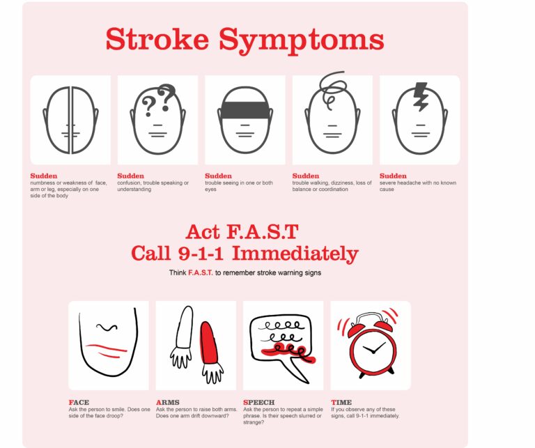 Topic - ACLS Case: Acute Stroke | ACLS Course | ACLS Certification ...