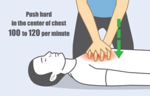 Topic - High-Quality CPR | BLS Course | ACLS Certification Association