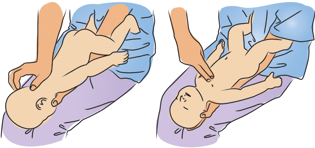 Topic - Relief of Choking in a Responsive Infant