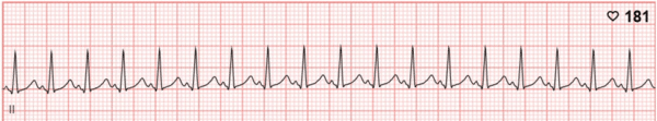 ACLS Megacode Scenario 1 | ACLS Simulator | ACLS Certification Association
