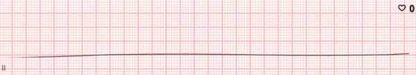 ACLS Megacode Scenario 1 | ACLS Simulator | ACLS Certification Association
