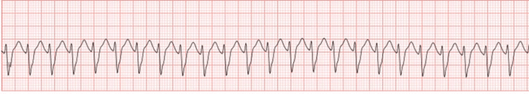 ACLS Megacode Scenario 1 | ACLS Simulator | ACLS Certification Association
