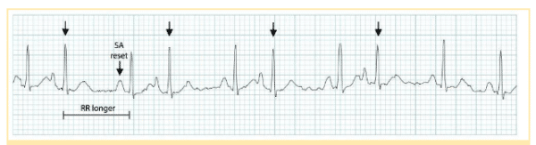 Topic - Regularity | Arrhythmia Interpretation Certification Course ...