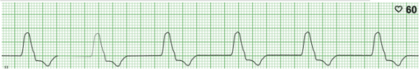 ACLS Megacode Scenario 8 | ACLS Simulator | ACLS Certification Association