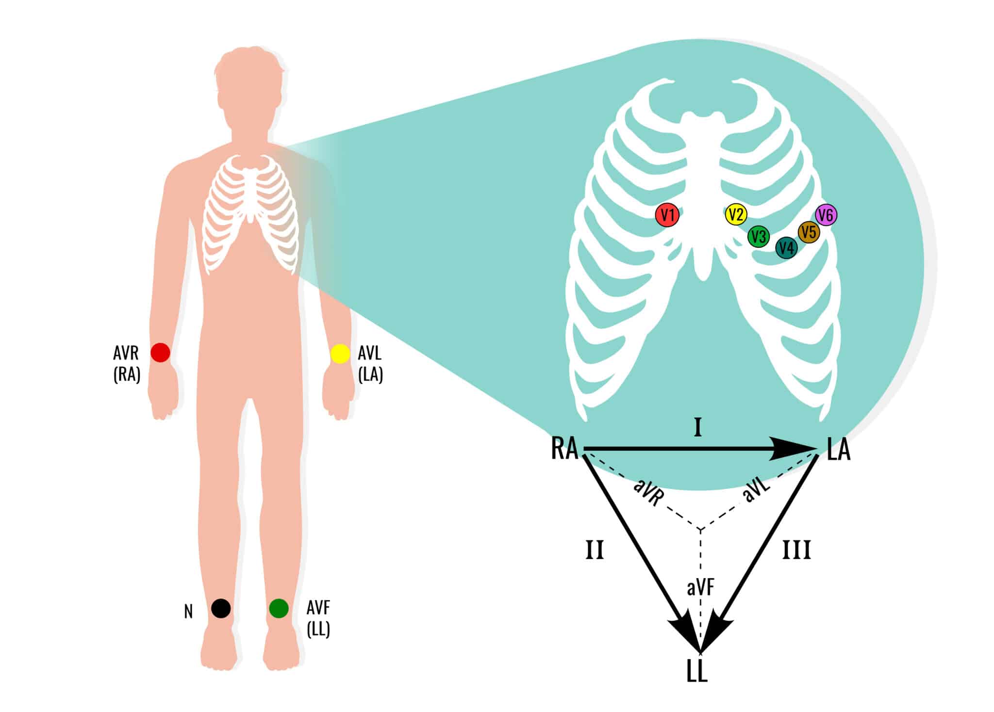 Topic - Monitoring the Leads | Arrhythmia Interpretation Certification ...