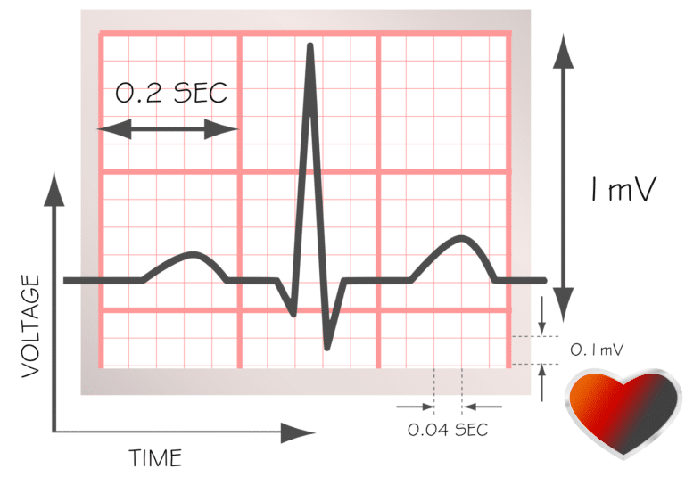 Topic - Understanding the ECG Grid | Arrhythmia Interpretation ...