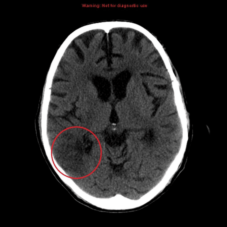Assessment Flashcard 8 | ACLS Flashcards | ACLS Certification Association