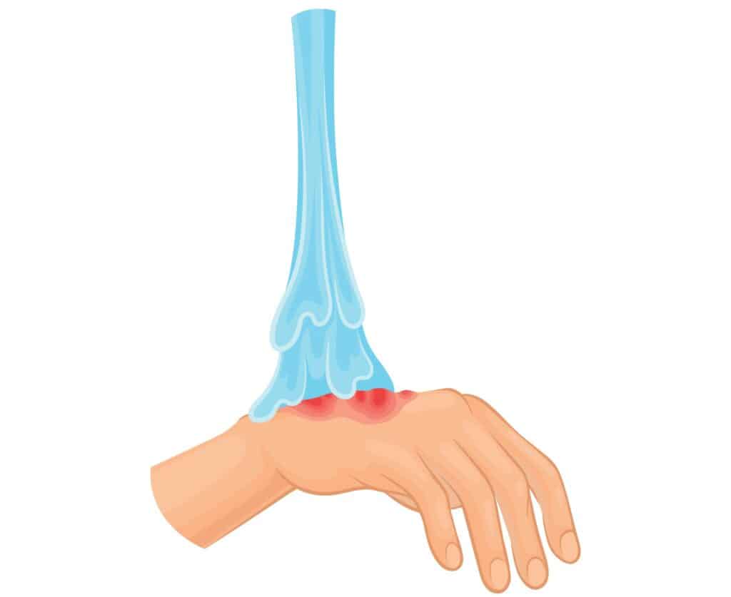 Care of Burn Patients | CPR, AED & First Aid Resources | ACLS ...