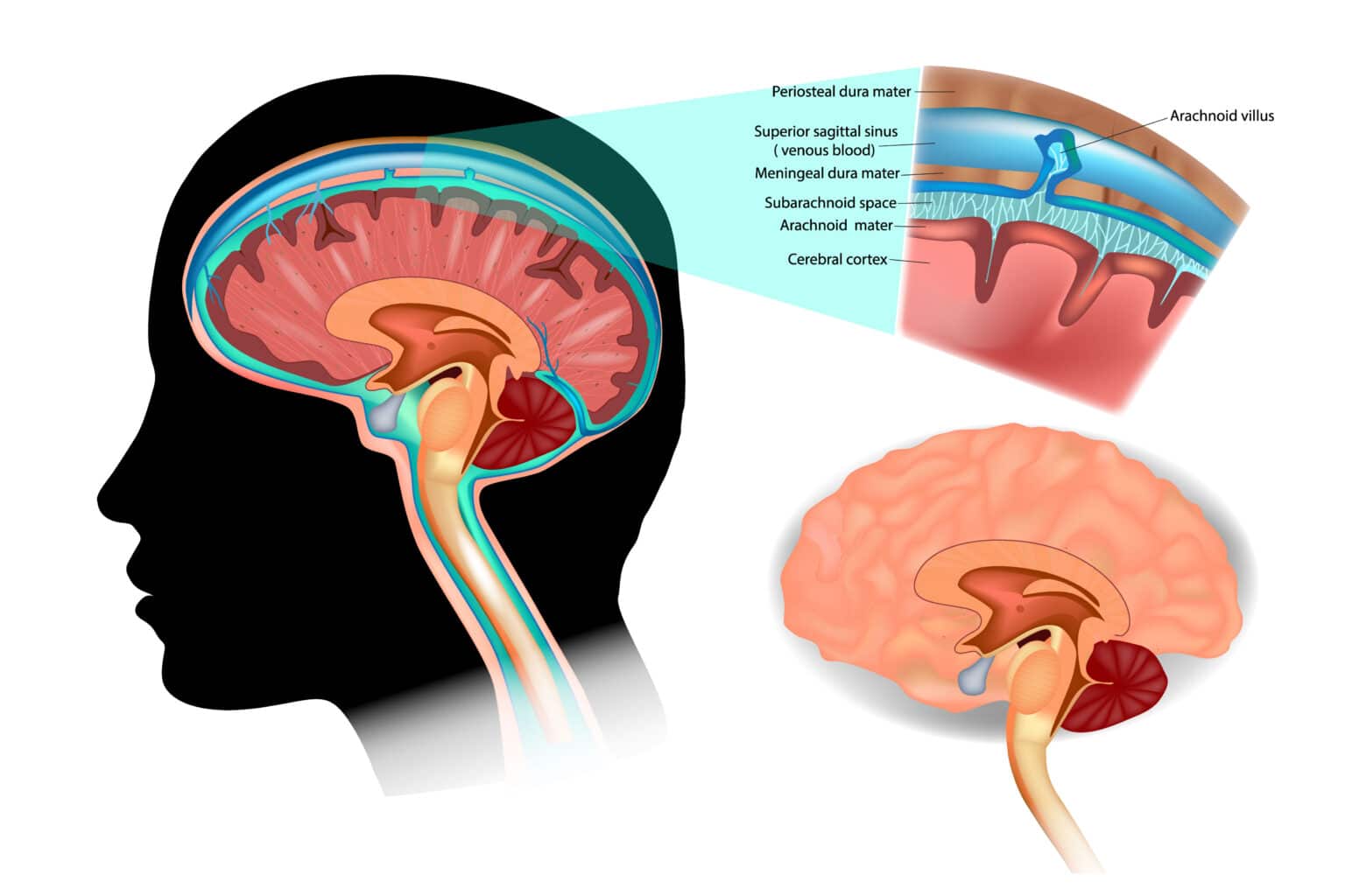 Pathophysiology of Increased Intracranial Pressure | ACLS Resources ...