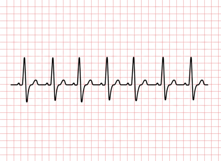 EKG & ECG Interpretation Explained | ACLS Certification Association