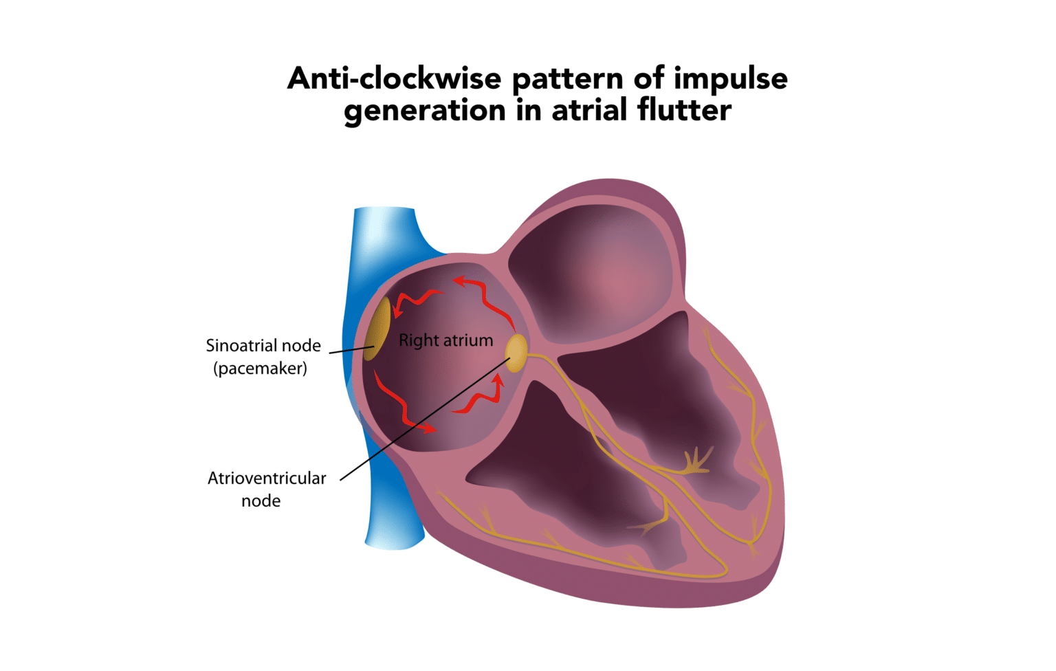 Rhythms Originating from the Atrium | 12-Lead ECG Resources | ACLS ...