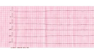 Ultimate Guide to ACLS Algorithms: Cardiac Arrest | ACLS Resources ...