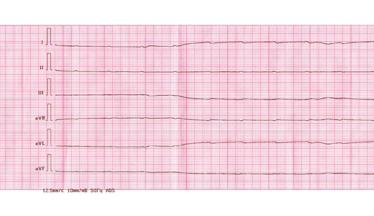 Ultimate Guide to ACLS Algorithms: Cardiac Arrest | ACLS Resources ...