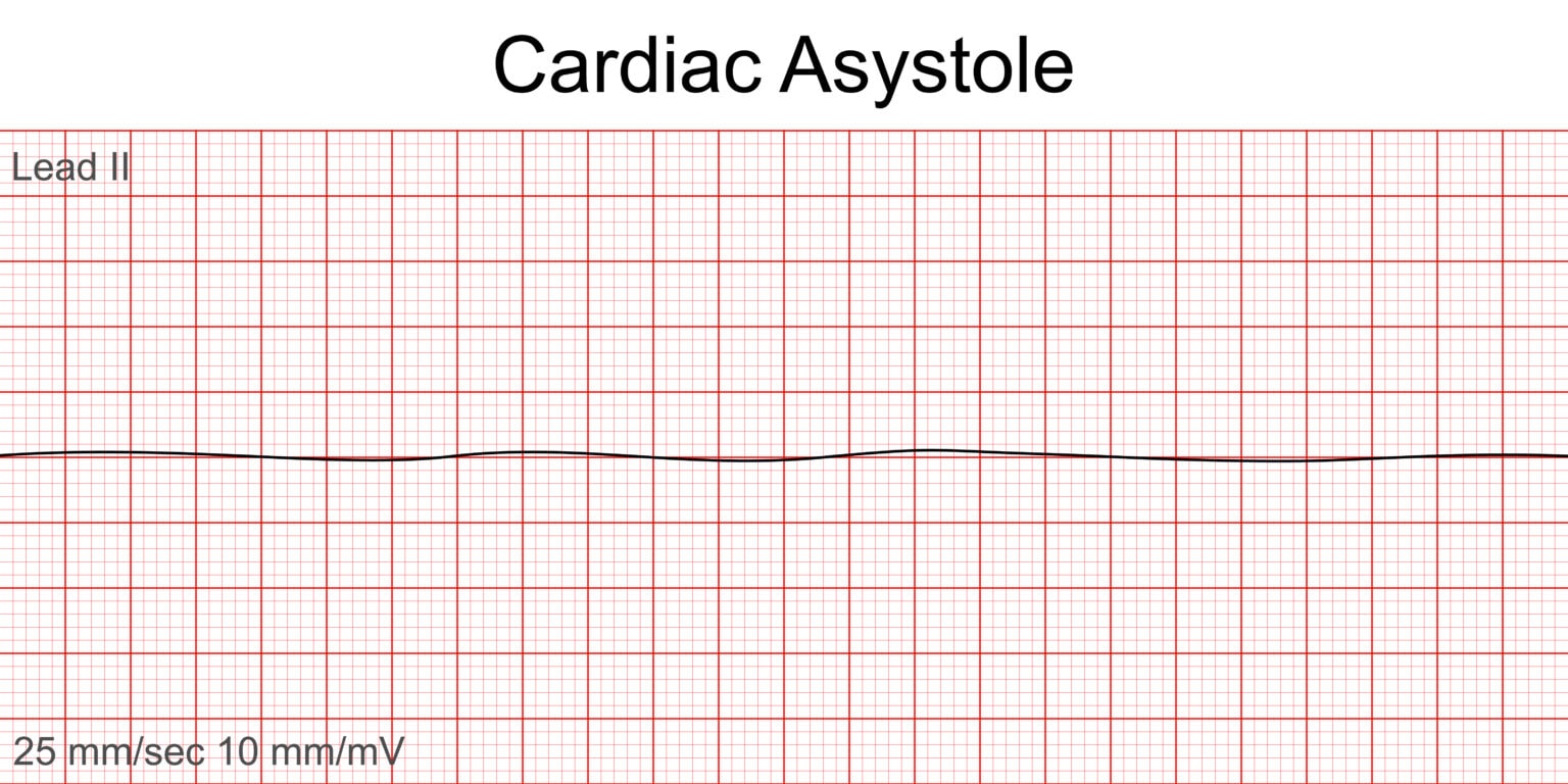 ACLS Asystole and PEA Algorithm | ACLS Resources | ACLS Certification ...
