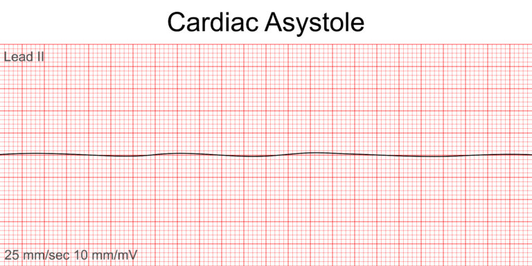 ACLS Asystole and PEA Algorithm | ACLS Resources | ACLS Certification ...