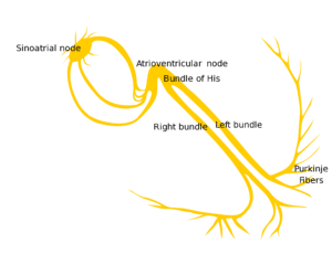 Atrioventricular Block or AV Block | 12-Lead ECG Resources | ACLS ...