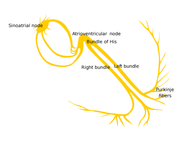 Atrioventricular Block or AV Block | 12-Lead ECG Resources | ACLS ...