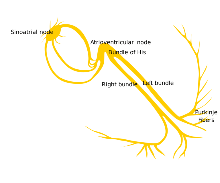 Atrioventricular Block or AV Block | 12-Lead ECG Resources | ACLS ...