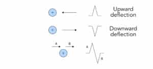 EKG & ECG Interpretation Explained | ACLS Certification Association