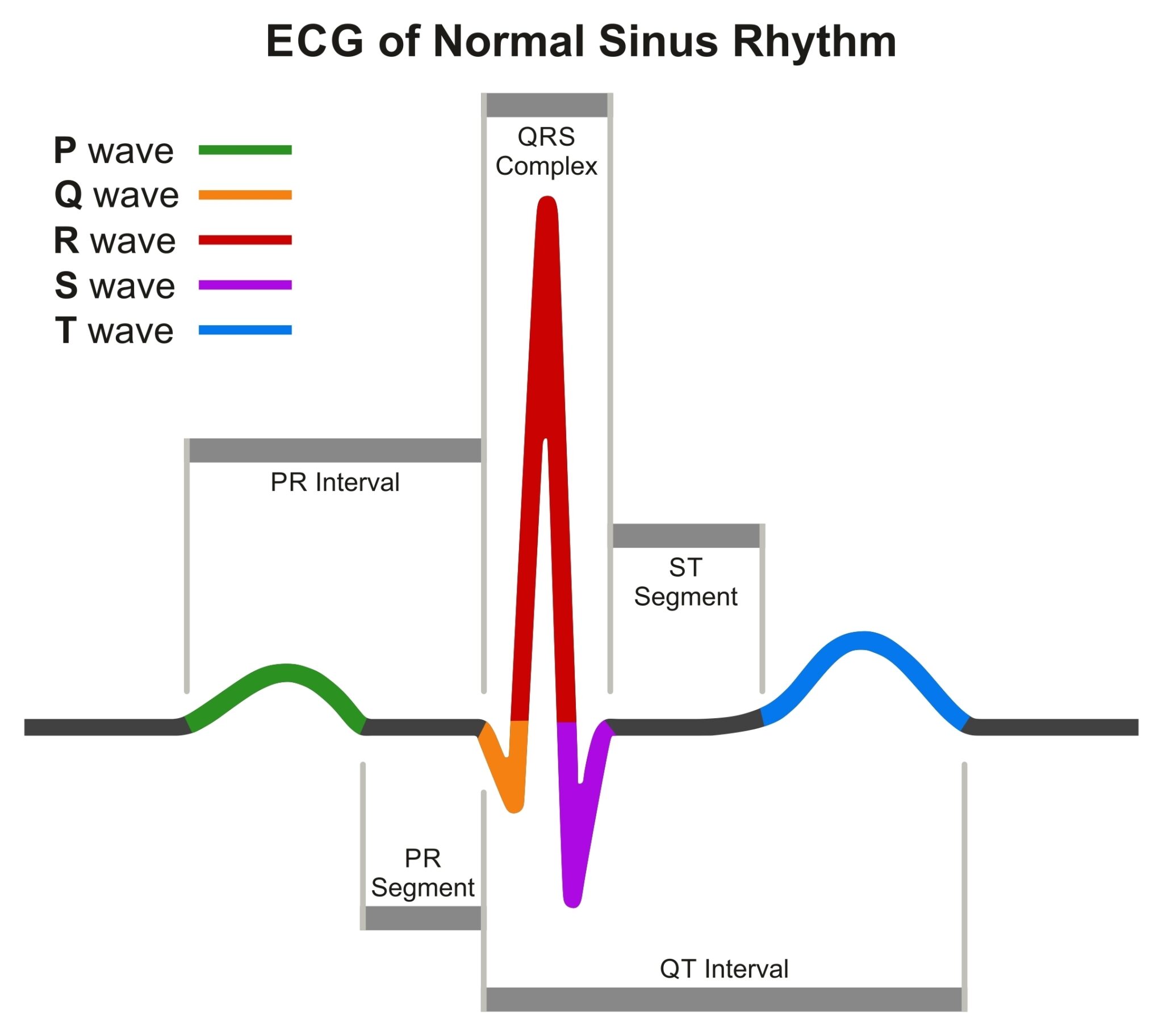 EKG & ECG Interpretation Explained | 12-Lead ECG Resources | ACLS ...