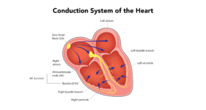 Junctional Rhythms | 12-Lead ECG Resources | ACLS Certification Association