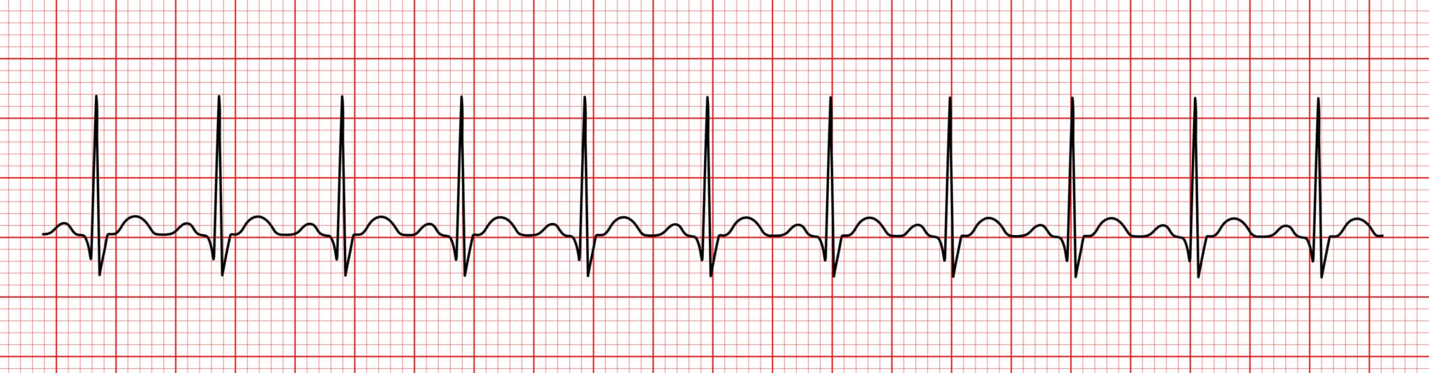 Assessing Appropriateness for Clinical Condition in Tachycardia | ACLS ...