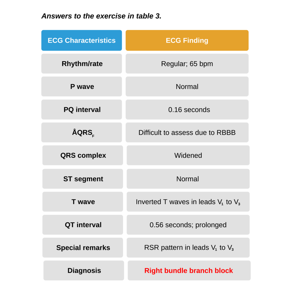 Topic - Definitive Electrocardiogram Diagnosis | 12-Lead ECG ...