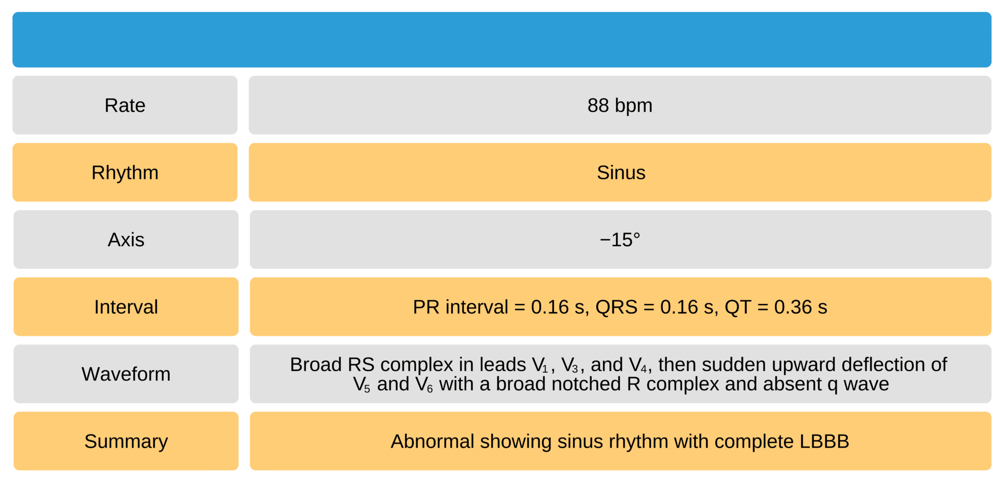 Topic - Incomplete Left Bundle-Branch Block | 12-Lead ECG Certification ...
