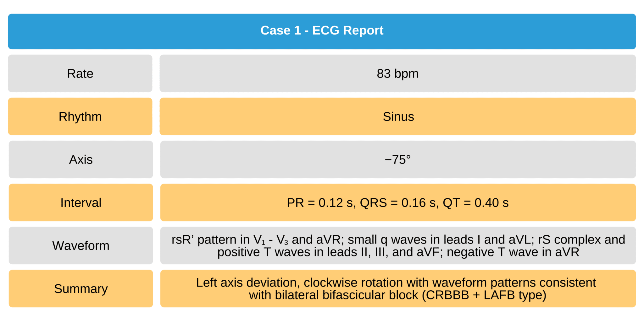 Topic - Right Bundle-Branch Block with Left Anterior Fascicular Block ...