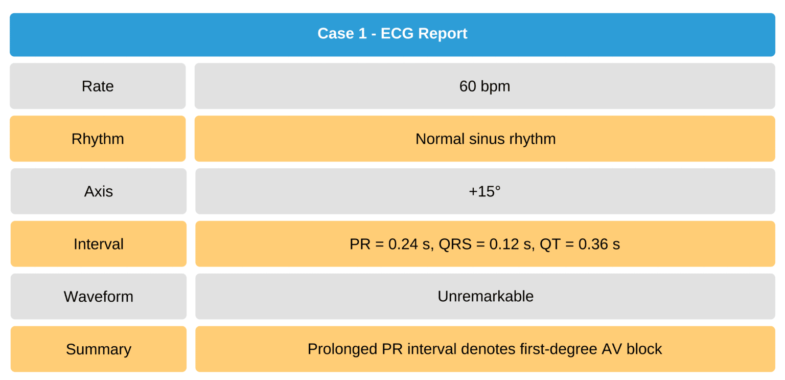 Topic - First-Degree AV Block | 12-Lead ECG Certification Course | ACLS ...