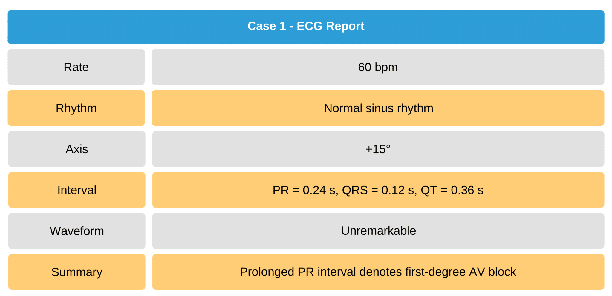 Topic - First-Degree AV Block | 12-Lead ECG Certification Course | ACLS ...