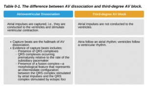 Topic - Atrioventricular Dissociation | 12-Lead ECG Certification ...