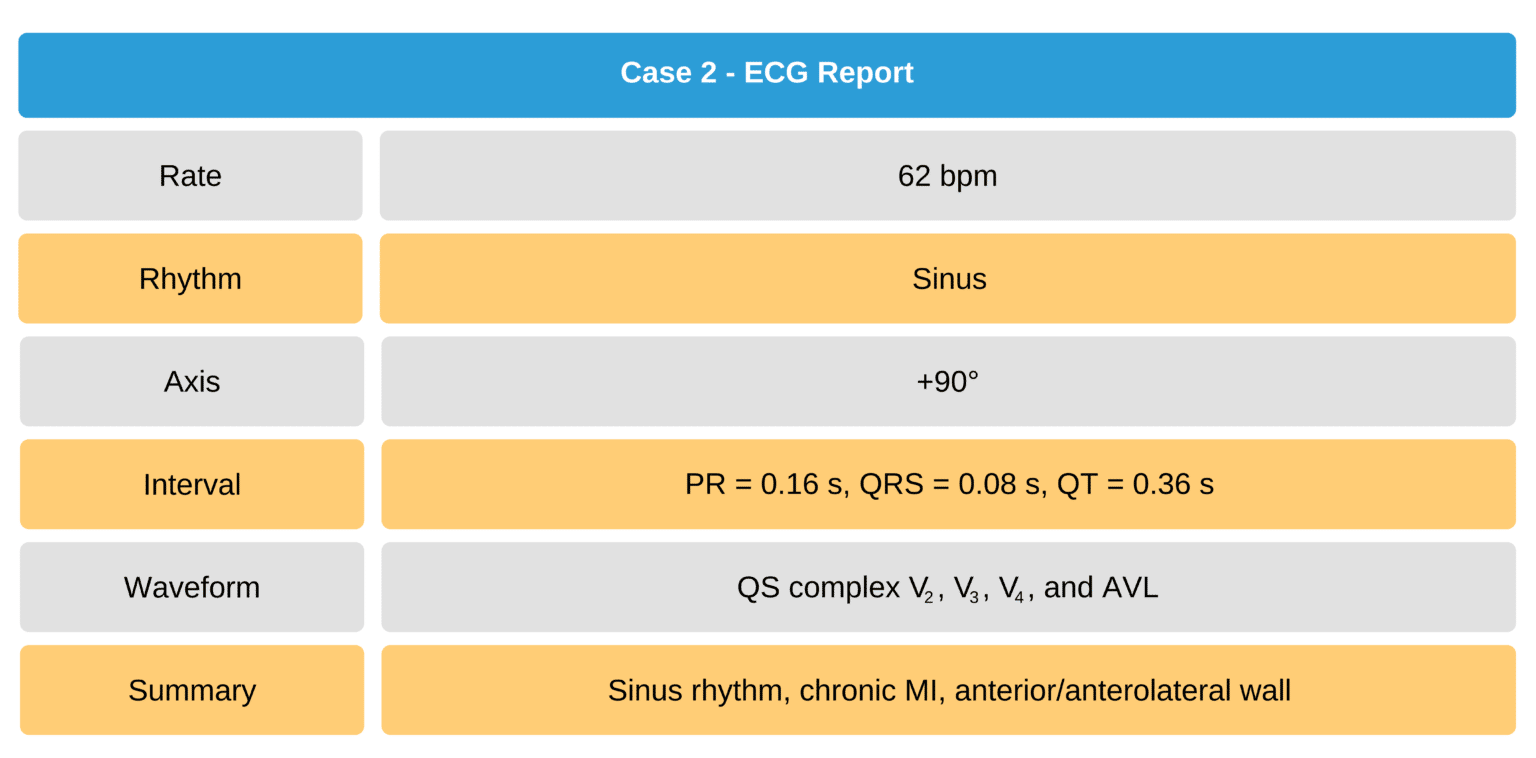 Topic - Localization of Q Wave Infarction | 12-Lead ECG Certification ...