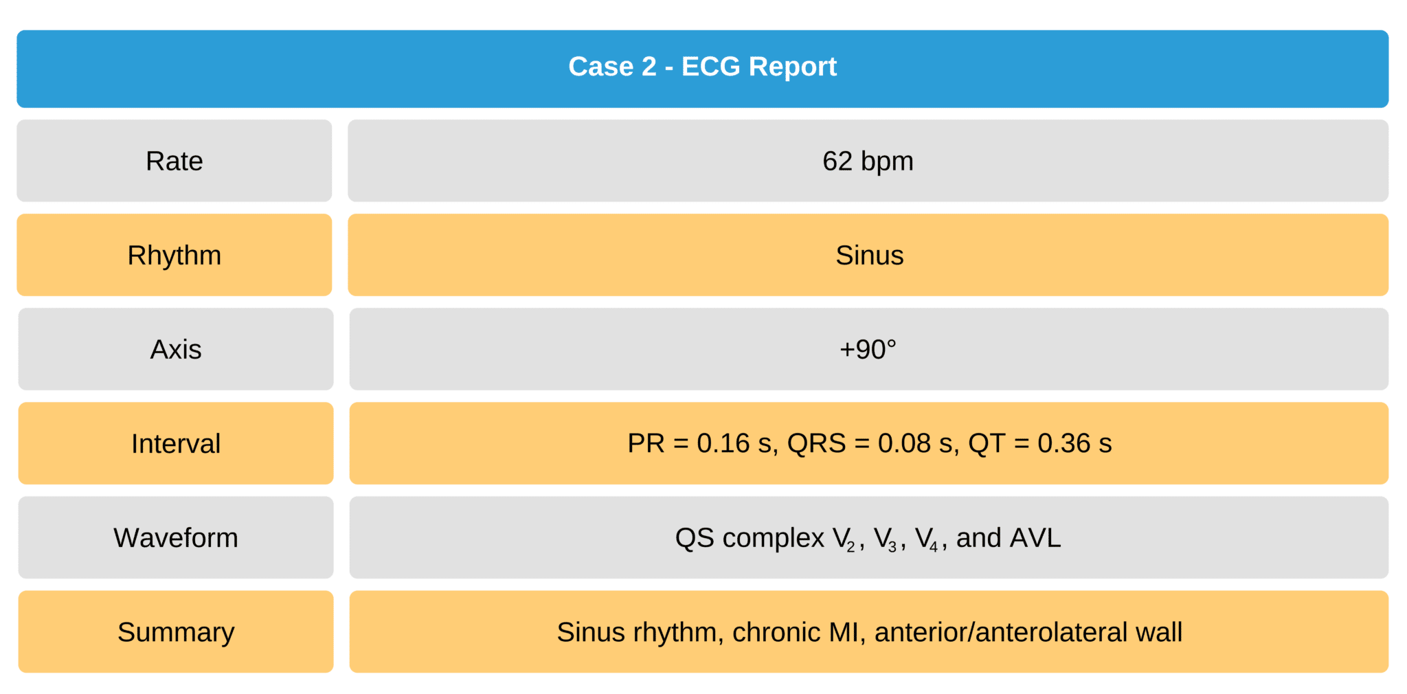 Topic - Localization of Q Wave Infarction | 12-Lead ECG Certification ...