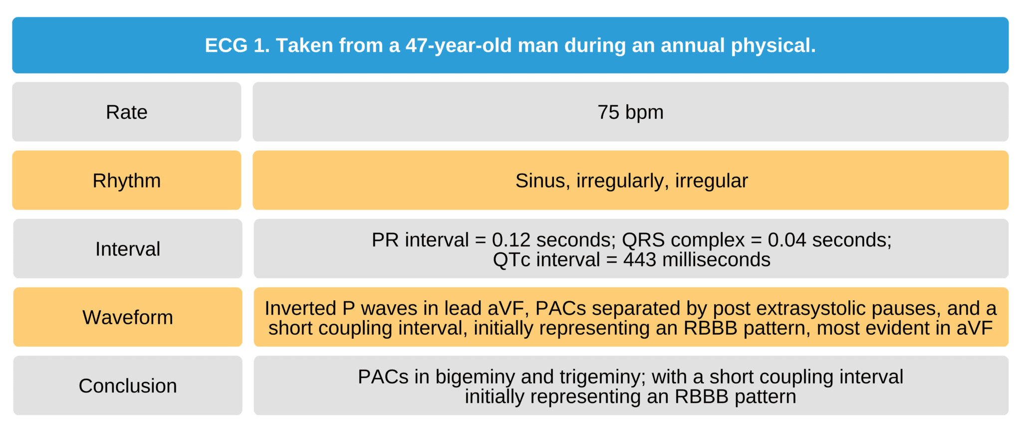 Topic - Premature Atrial Contractions in the Inferior Aspect of the ...