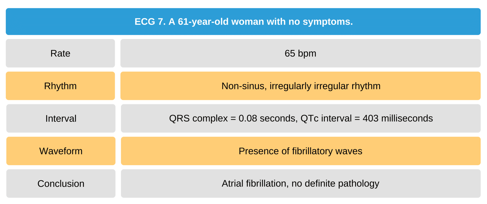 Topic - Atrial Fibrillation | 12 Lead ECG Course | ACLS Certification ...