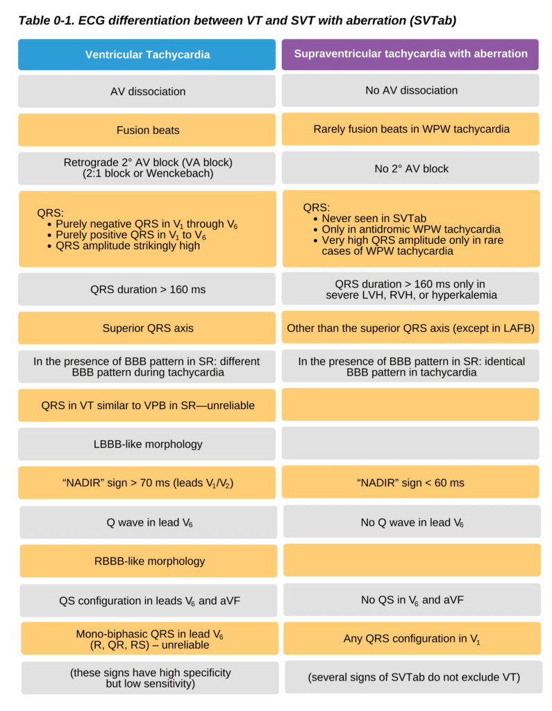 Topic - Differential Diagnosis (Ventricular Tachycardia) | 12-Lead ECG ...