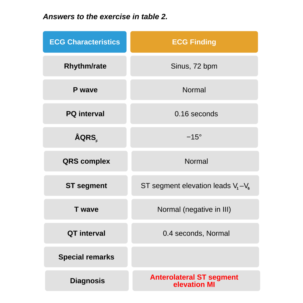 Topic - Definitive Electrocardiogram Diagnosis | 12-Lead ECG ...
