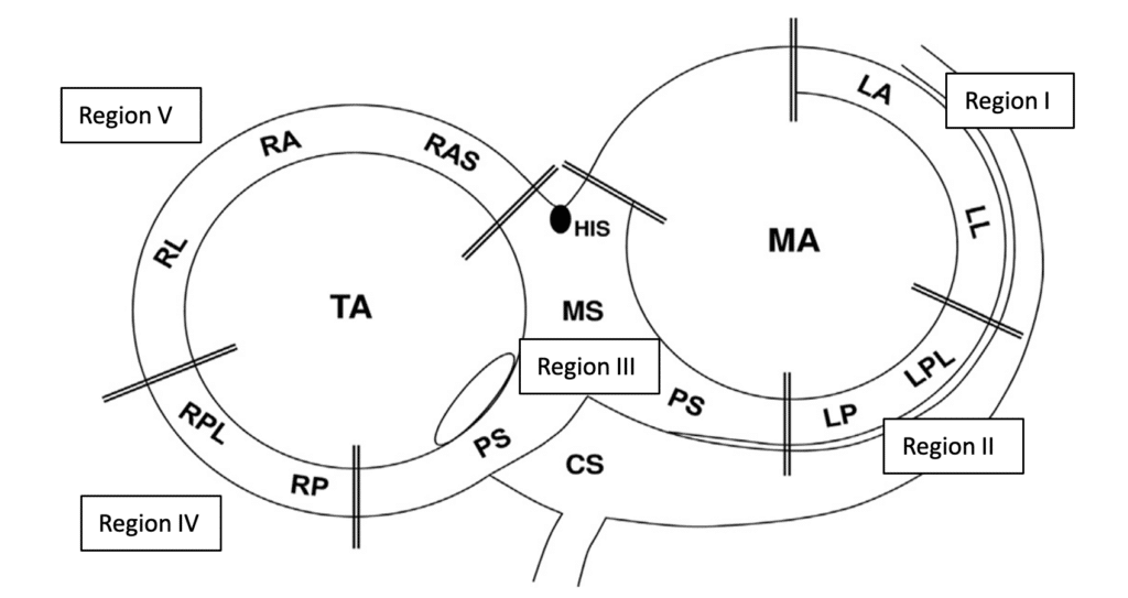 Topic - Electrocardiogram Patterns in Preexcitation | 12 Lead ECG ...