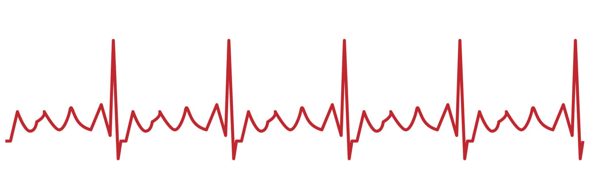 Topic - Atrial Flutter | 12 Lead ECG Course | ACLS Certification ...