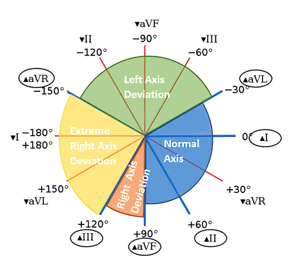 Topic - The Cardiac Axis | 12 Lead ECG Course | ACLS Certification ...