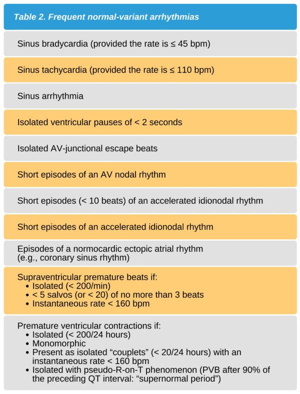 Topic - Arrhythmia | 12-Lead ECG Certification Course | ACLS ...