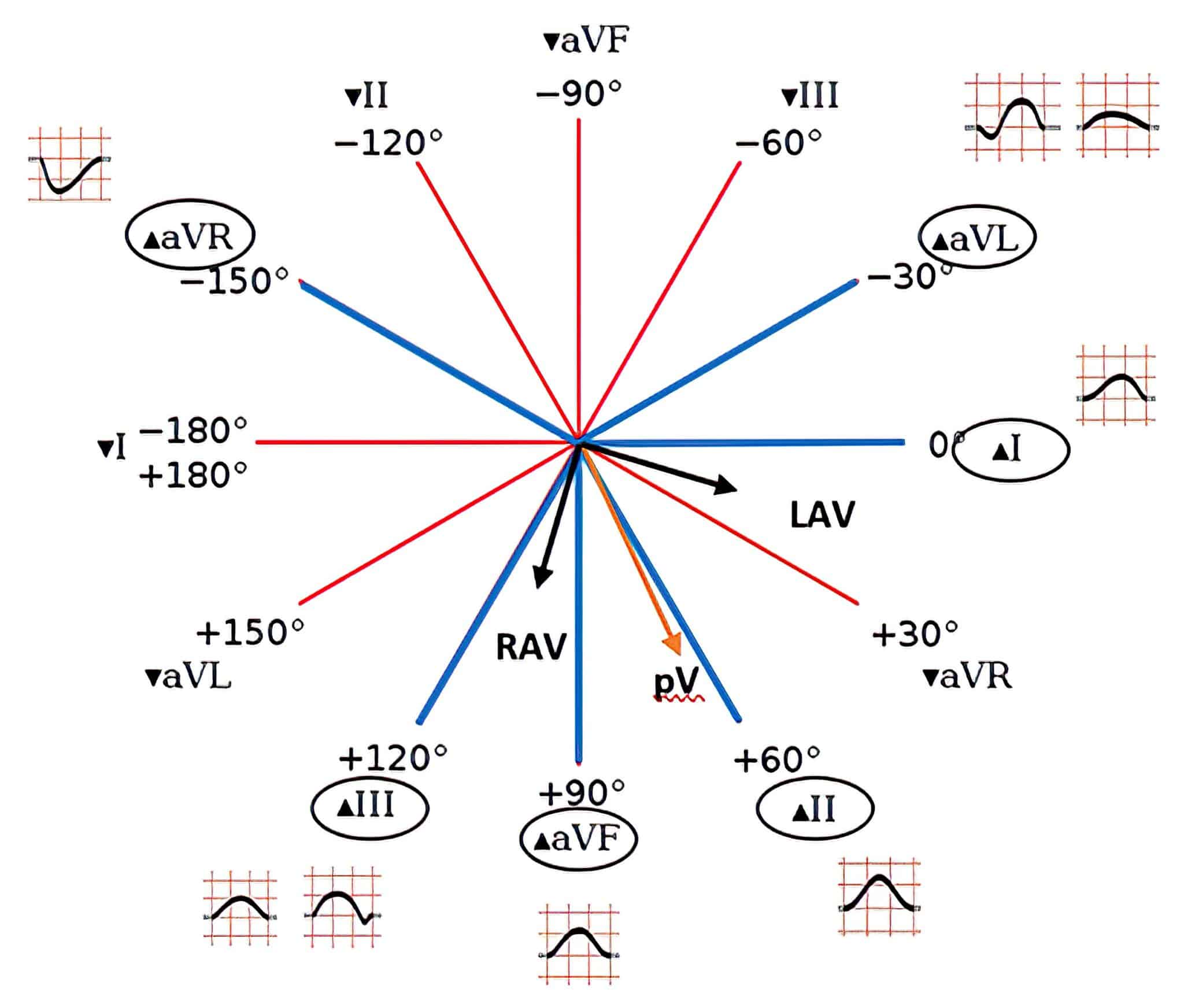 Topic - P Wave | 12 Lead ECG Course | ACLS Certification Association