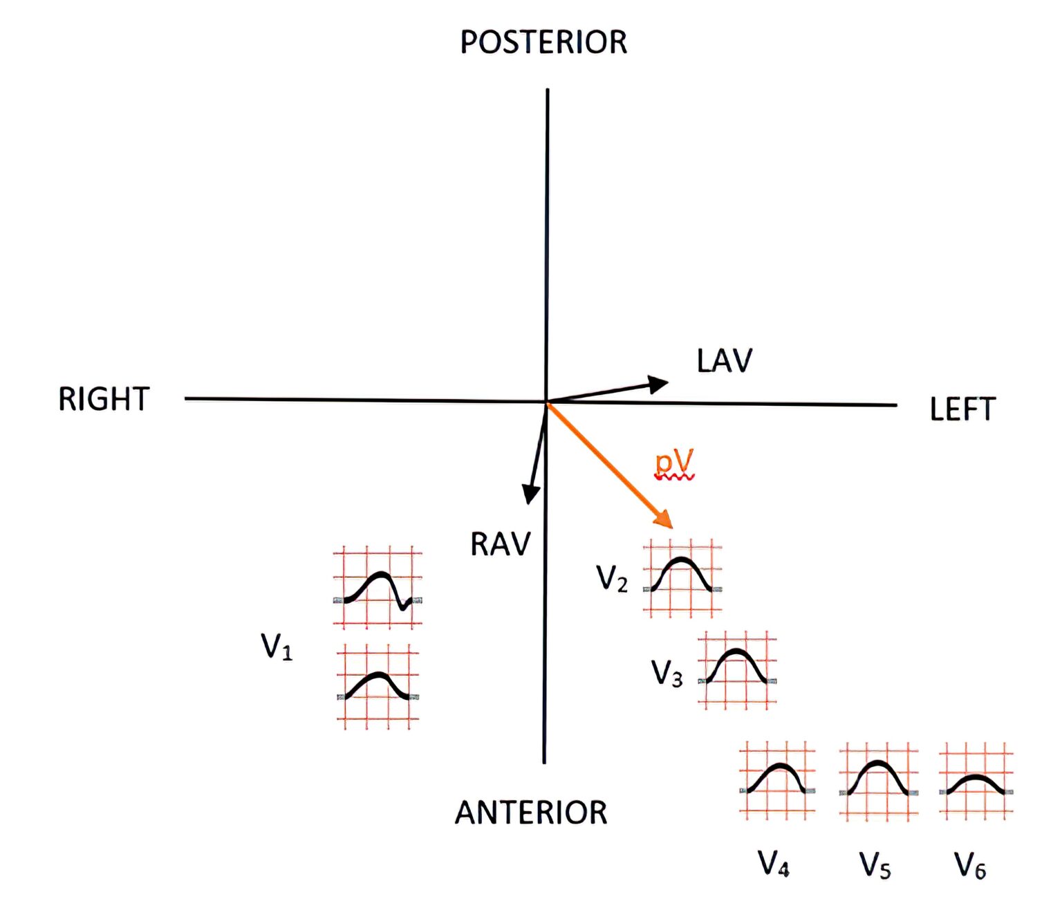 Topic - P Wave | 12 Lead ECG Course | ACLS Certification Association