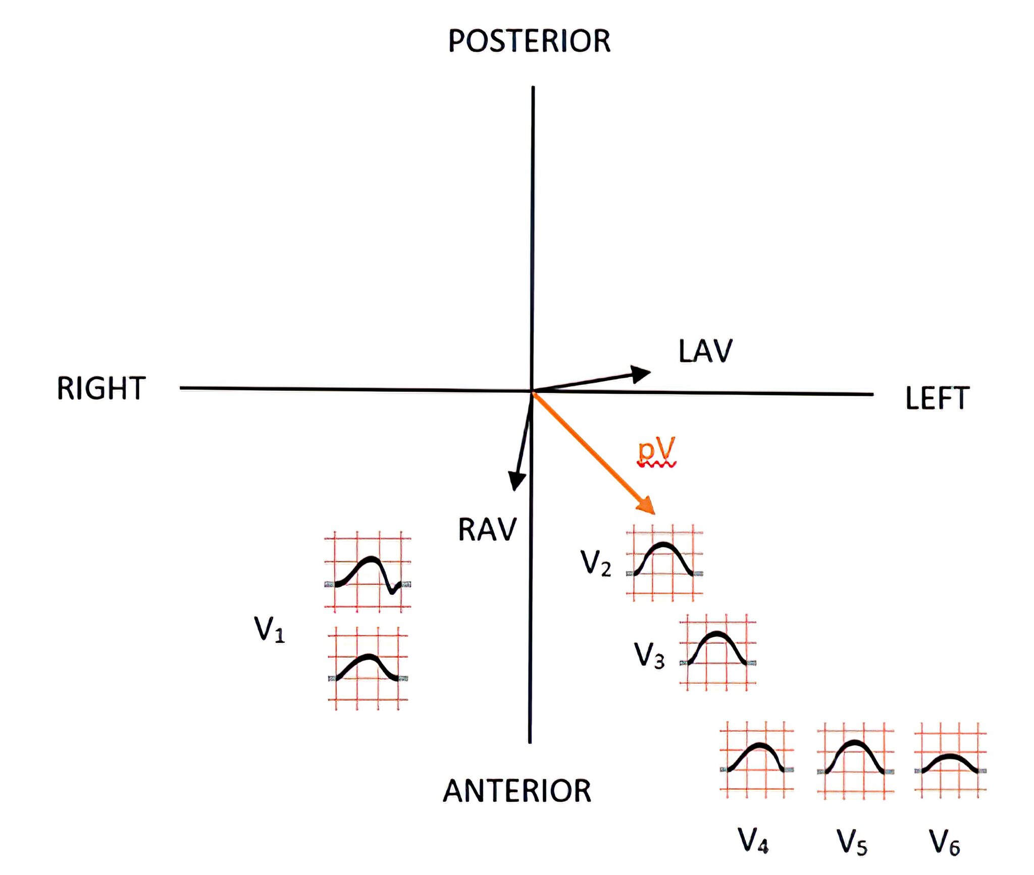 Topic - P Wave | 12-Lead ECG Certification Course | ACLS Certification ...